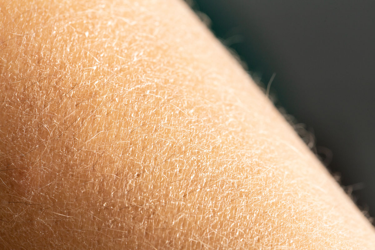 8 Solutions For Dry, Itchy Skin in Menopause