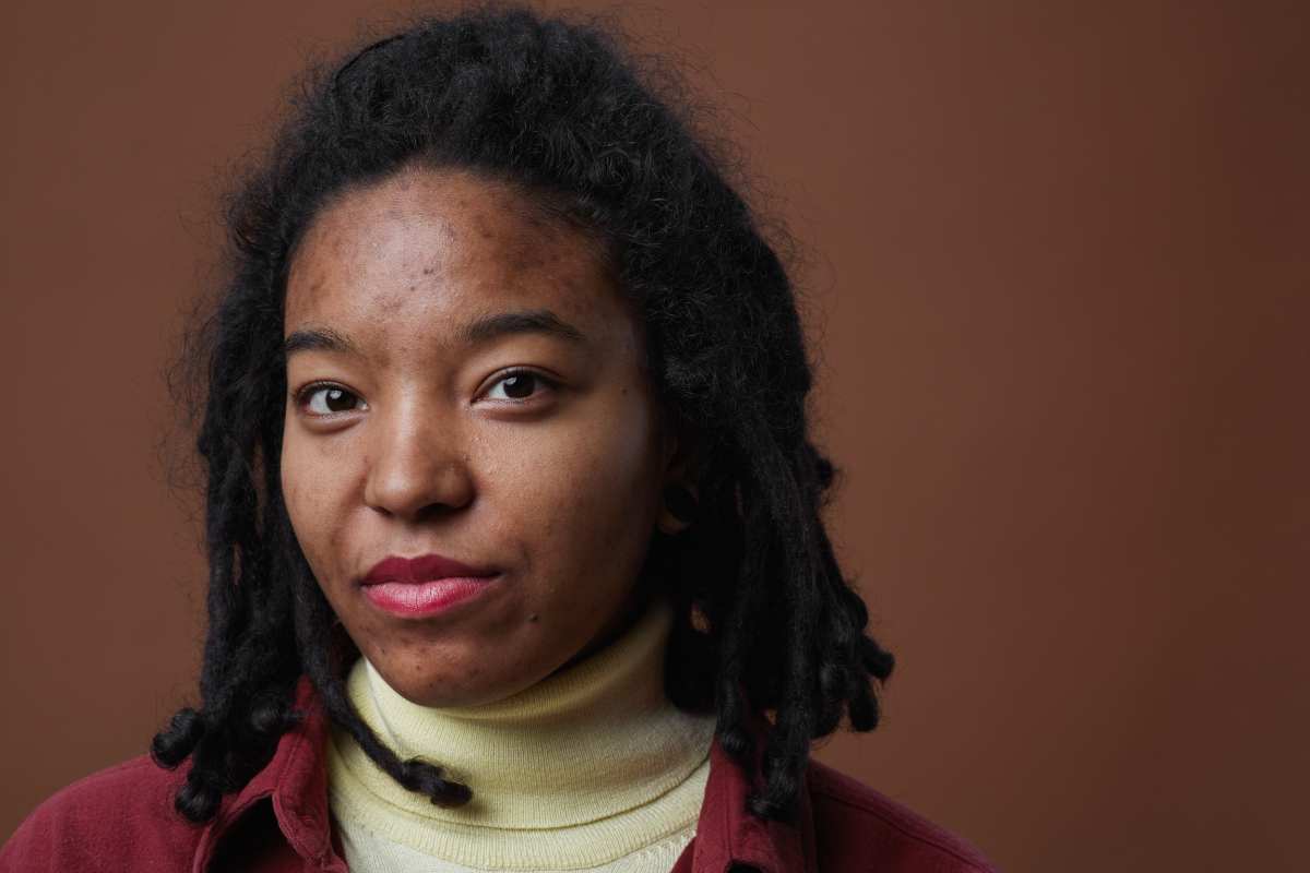 Why Does Menopause Acne Happen and How to Treat Your Skin